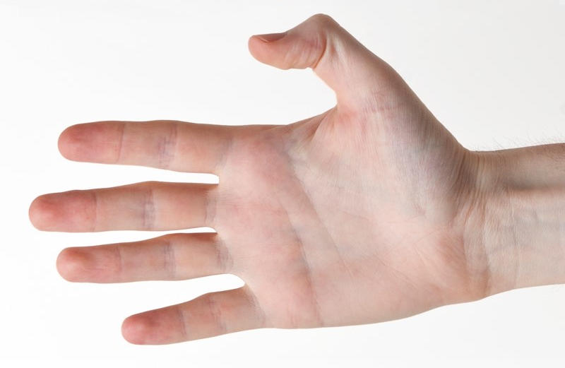 The sound of one hand clapping – gene networks in cancer – project ...